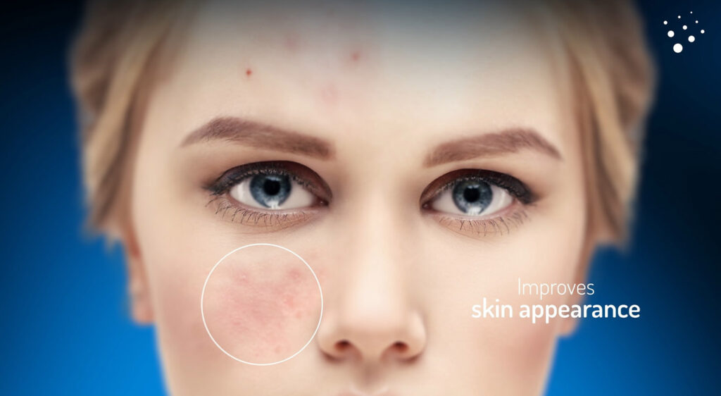Cool Laser™ Skin Resurfacing | Rejuvena Laser & Aesthetic Clinic